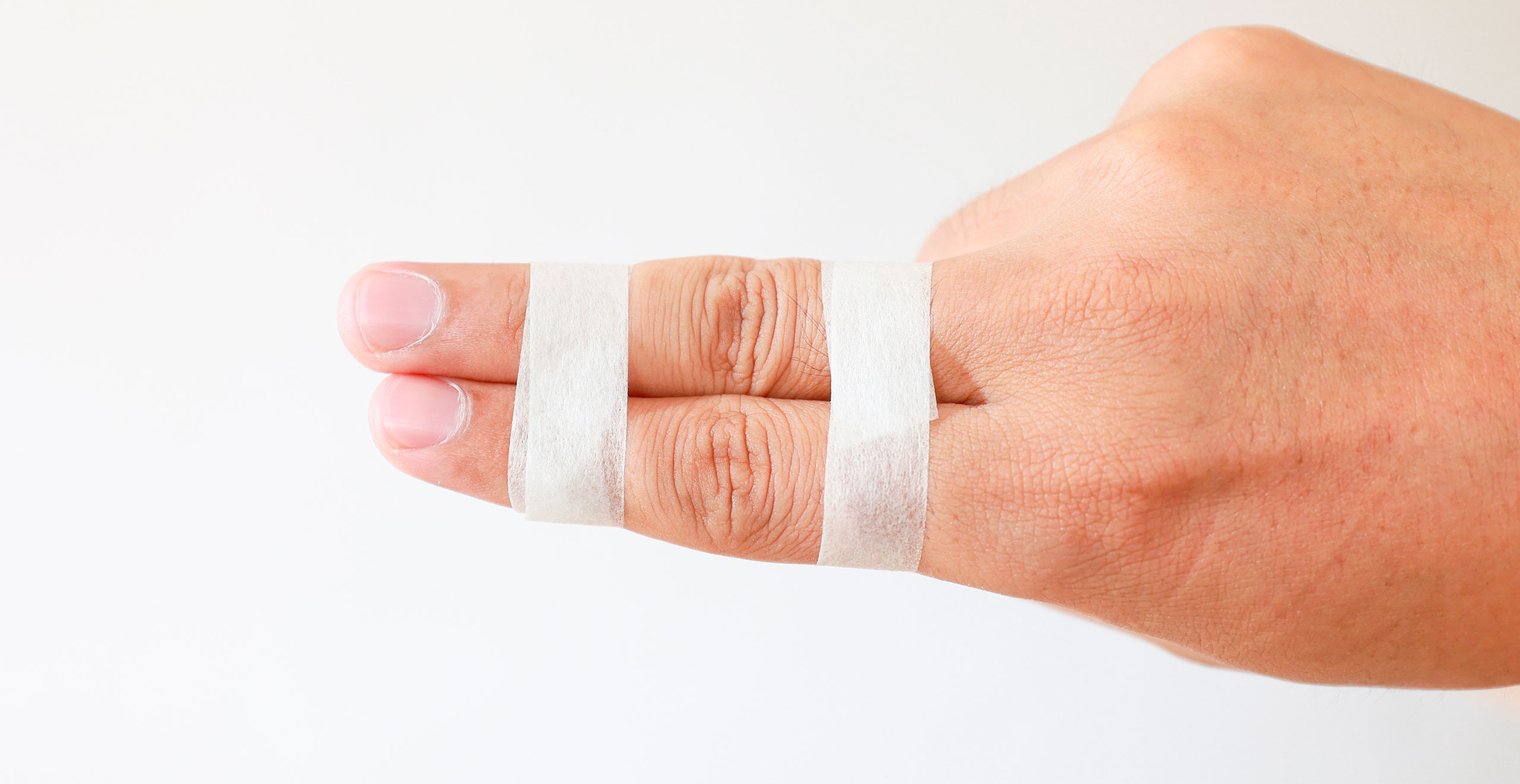 Entorse et luxation des doigts | Institut de kinésithérapie | Paris